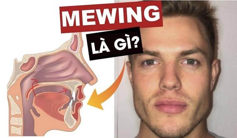 Mewing là gì?Những hiệu quả khi tập luyện phương pháp Mewing